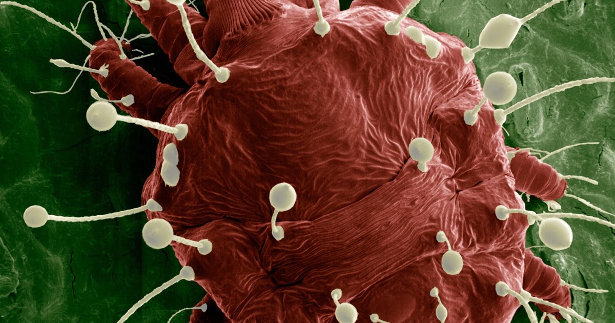 Real Monstrosities: Red Palm Mite