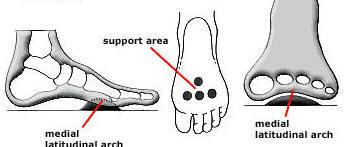 Let's Talk About Feet by Pedag: Which Metatarsal Pad is Right for Me ...