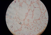 Bacteriologia: Bacterias patogenas