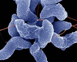 Materia Medica Homeopatica: MORGAN (Nosode Intestinal de Bach)