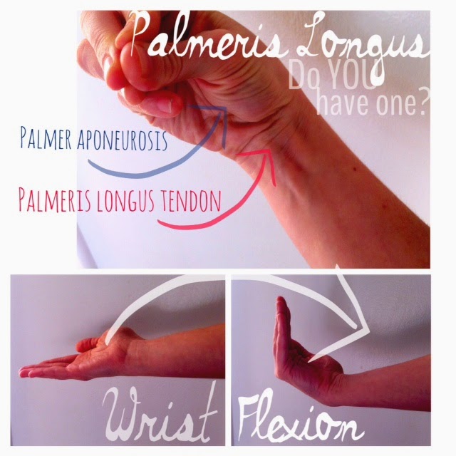 The Hip Joint: Palmaris Longus : wrist flexor muscle