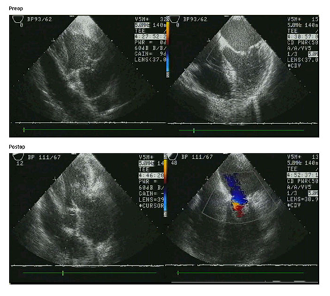 ALAT DIAGNOSTIK : ECHOCARDIOGRAPHY ~ Edukasi Elektromedik