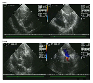 ALAT DIAGNOSTIK : ECHOCARDIOGRAPHY ~ Edukasi Elektromedik
