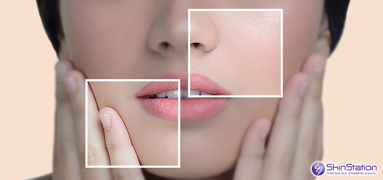 SkinStation: HOW TO MAKE YOUR PORES (ALMOST) DISAPPEAR