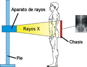 TSU Radiodiagnostico UNERG: Rayos X