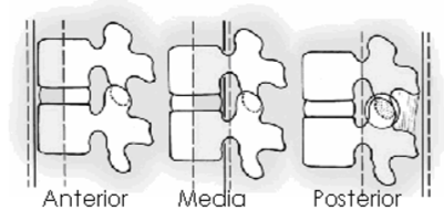 11:50: Describa las tres columnas de Denis