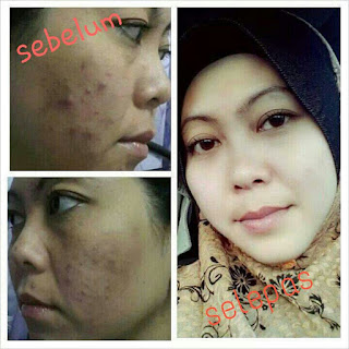 Testimoni Firmax3 Cream - Toko Firmax3 Indonesia