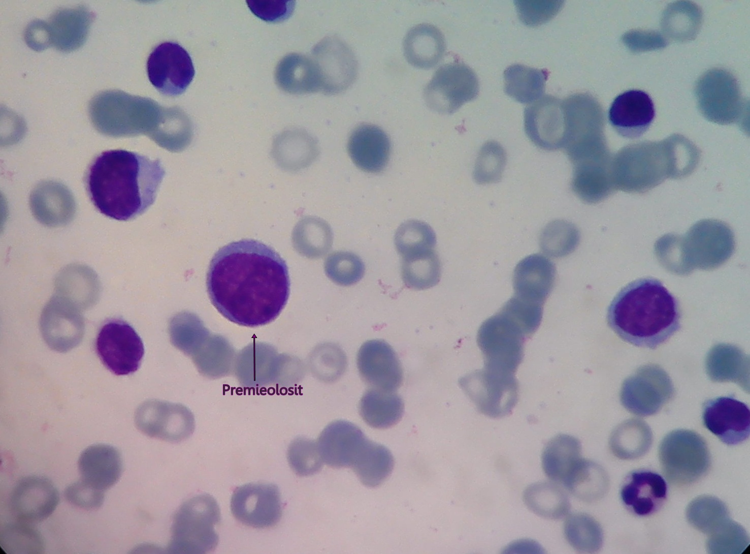 Seri - Seri Leukosit | Analis Kesehatan