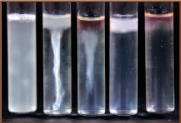 [Microbiology] Atlas of Cultivation of Anaerobes—Thioglycollate Broth ...