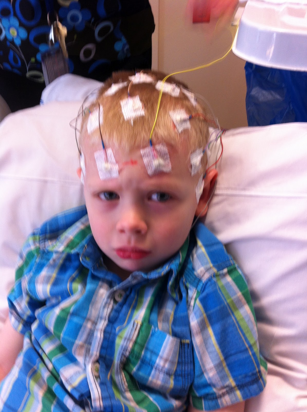 Joshua's Journey with Doose Syndrome: 48 Hour Video EEG in Hospital