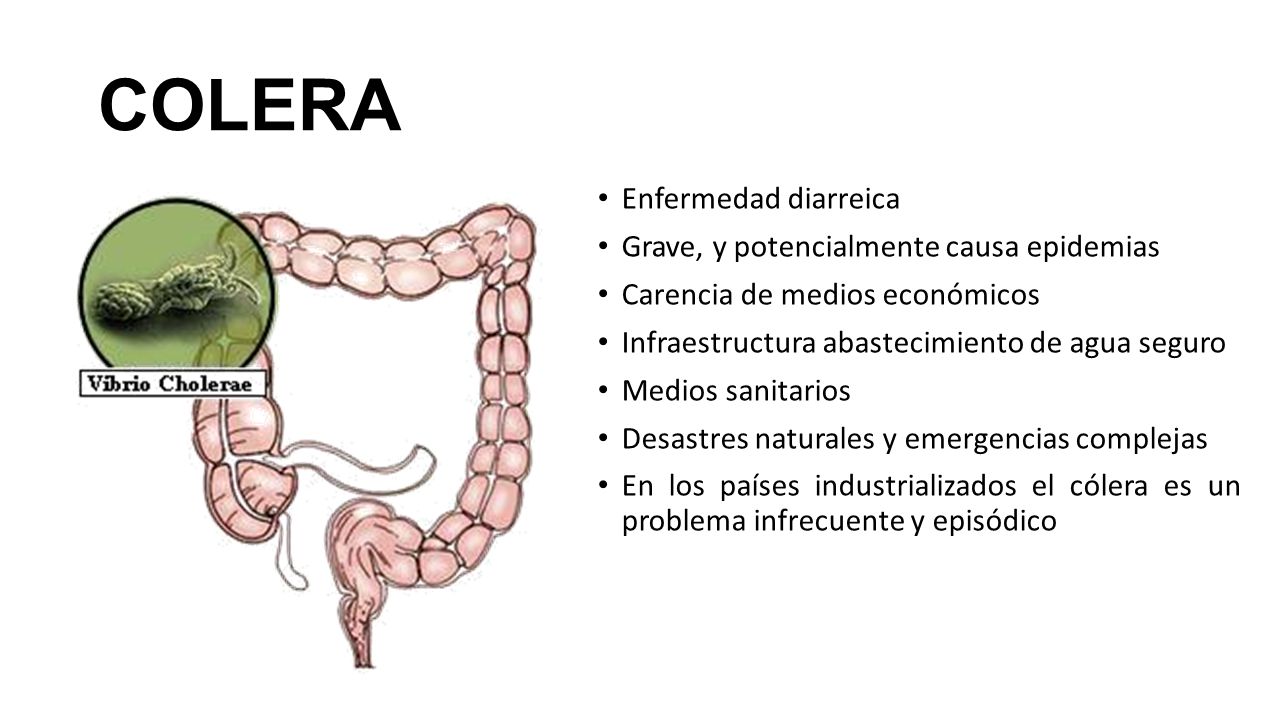 ENFERMEDADES ENDEMICAS: Definición de colera