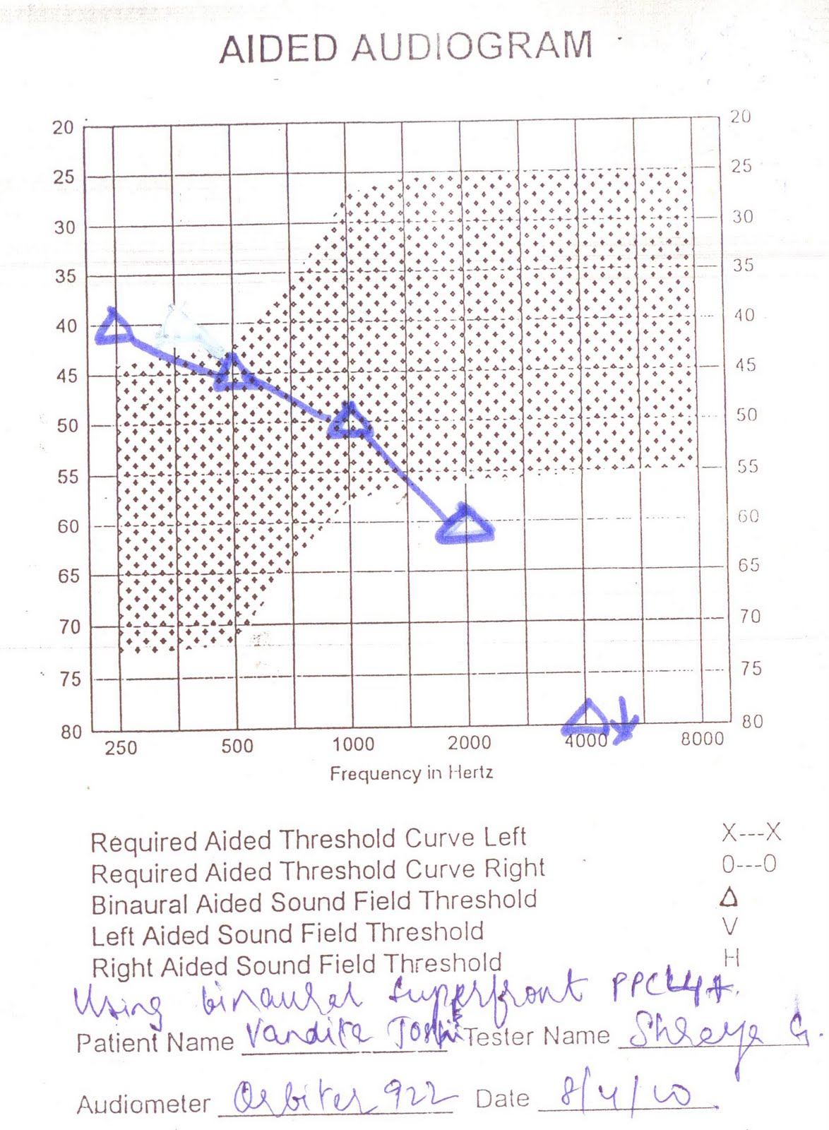 Vandita Can Talk: Vandita's Audiogram Before and After Cochlear Implant