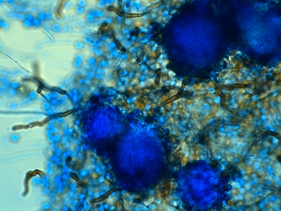 Fun With Microbiology (What's Buggin' You?): Phoma glomerata