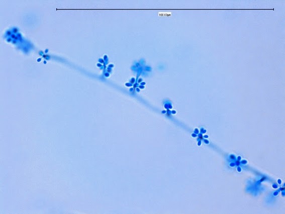 Fun With Microbiology (What's Buggin' You?): Sporothrix schenckii ...