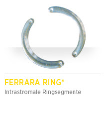 ศูนย์เลสิครัตนิน-กิมเบล โรงพยาบาลจักษุ รัตนิน: Ferrara ring ...