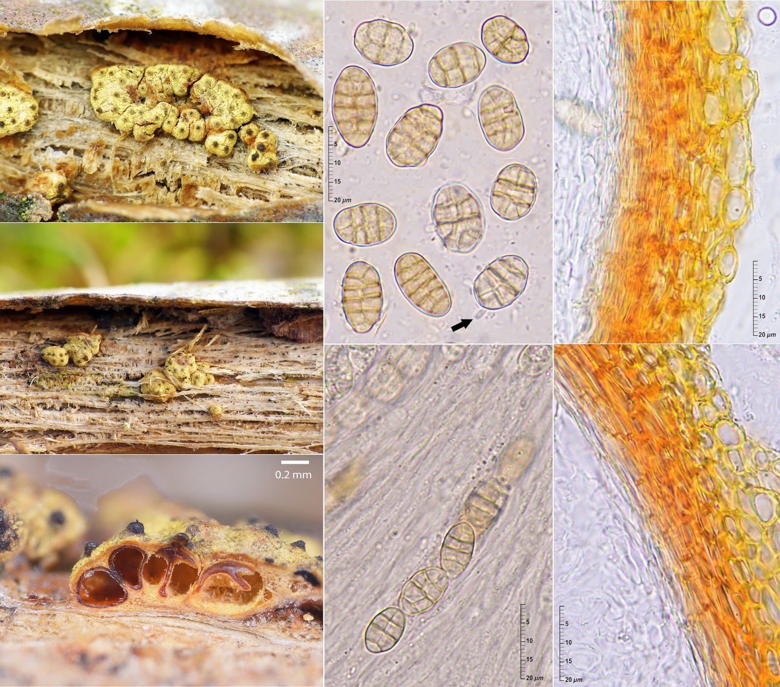Thyronectria rhodochlora (Mont.) Seeler • CEMAS Orden Hypocreales