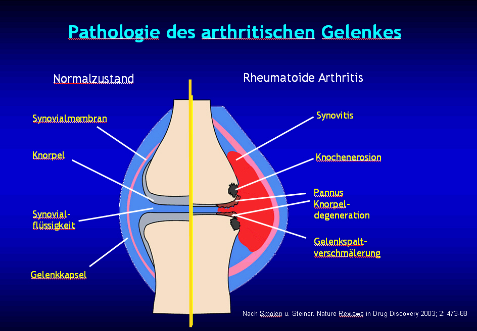Rheumatologe: Rheuma und Ernährung