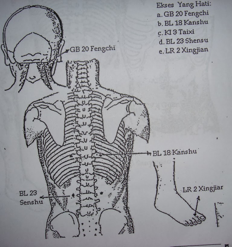 Rumah Terapi “PERMATA HOLISTIC”: TERAPI AKUPUNTUR UNTUK VERTIGO