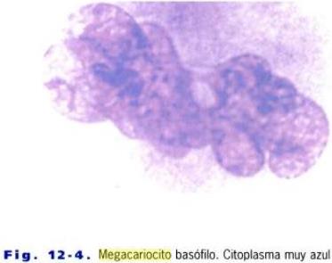 FICHERO DE HEMATOLOGIA: SERIE MEGACARIOCITICA PLAQUETARIA