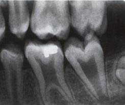 Dentistry and Medicine: Developmental anomalies of tooth - Diagram