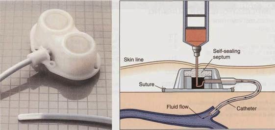 May 2015 - Shoshiplatypus