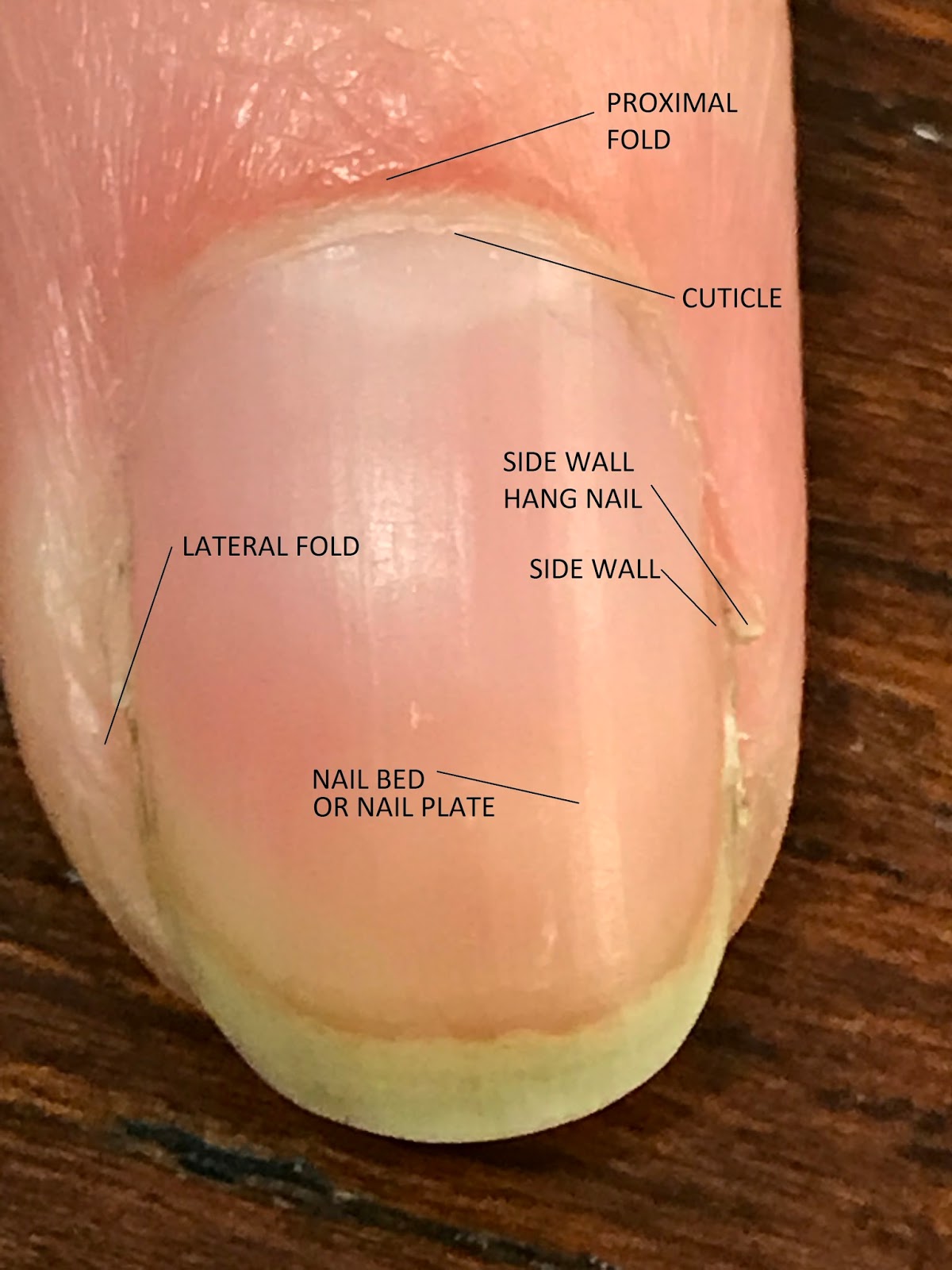 Nail Anatomy Wikidoc