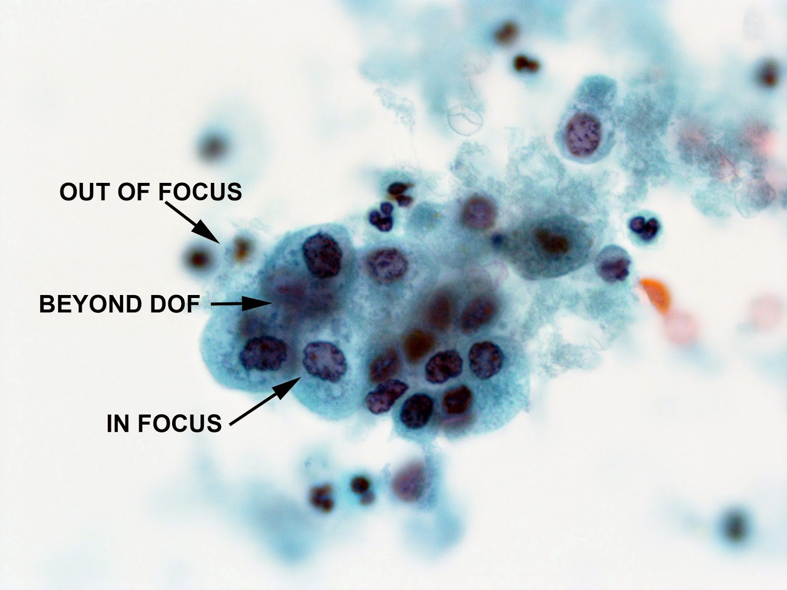 Pathology photography techniques: May 2015