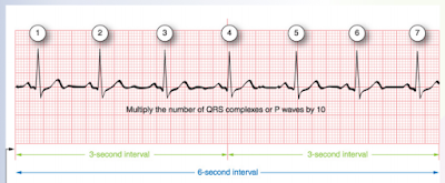 Traumagency: Count Irregular Rhythm HEART Rate
