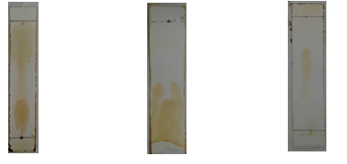 VIKRI HIDAYAT: LAPORAN KROMATOGRAFI LAPIS TIPIS