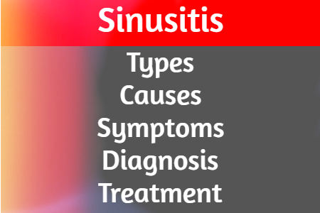 Sinusitis | 4 Types | Causes, symptoms, Diagnosis and treatment