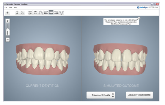 Your Markham Orthodontist, Toronto Invisalign, and Richmond Hill Braces ...