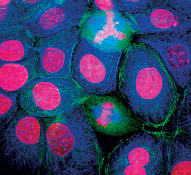 My Cancer My Call Tumor Markers PET Scans And Other Measures
