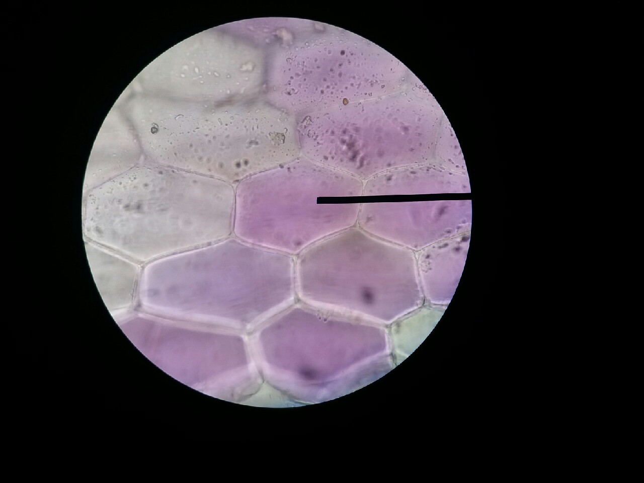 Biology: Penebalan Dinding Sel dan Plasmolisis