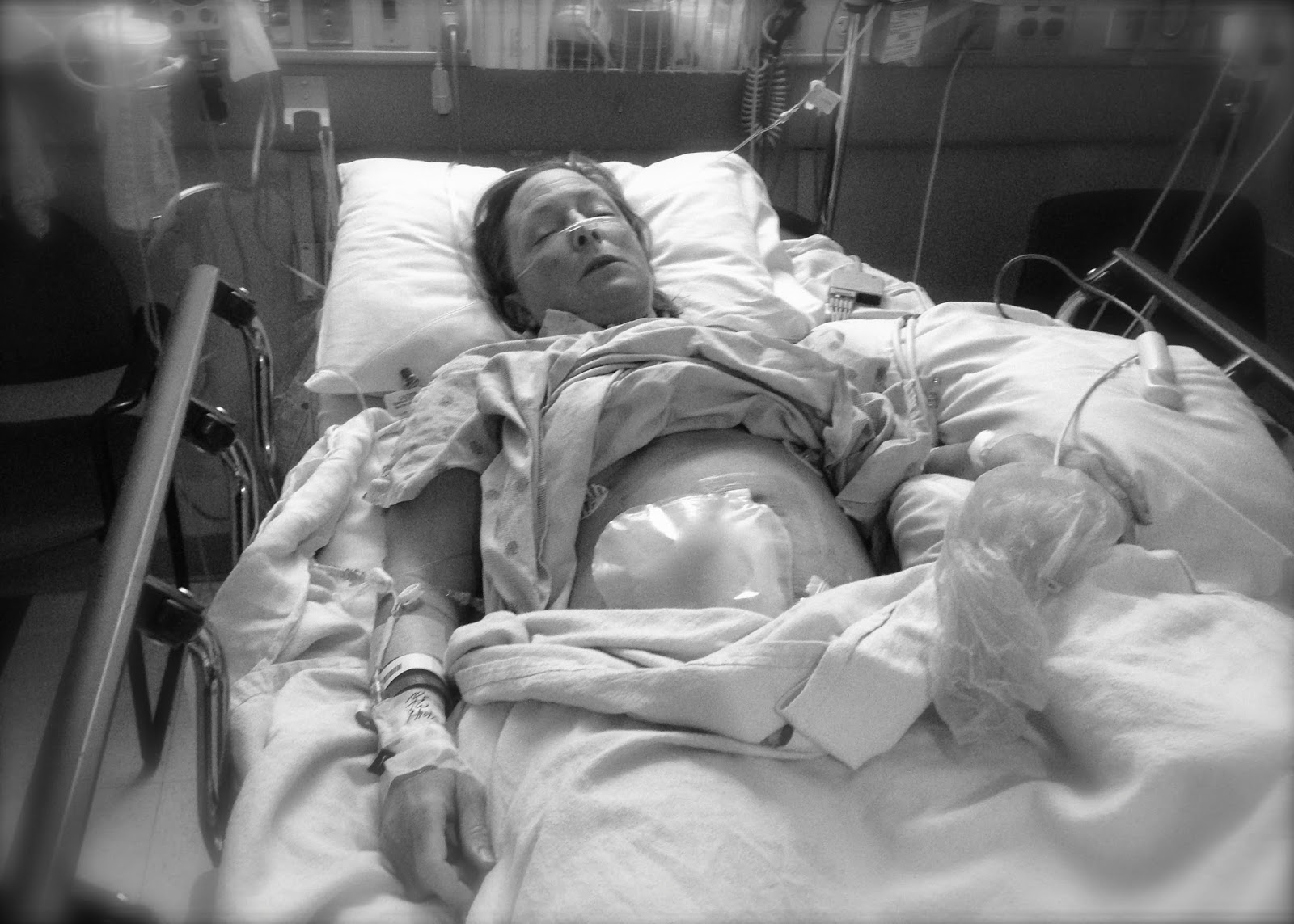 Green Monkey Tales: What's Left of Me