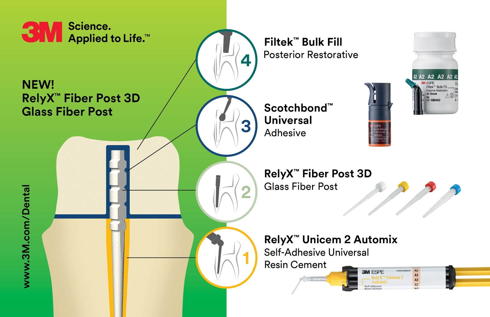 3M Oral Care Releases RelyX™ Fiber Post 3D Glass Fiber Post