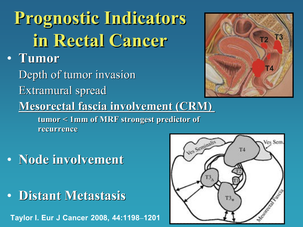 rsna: staging of colon and rectal cancer