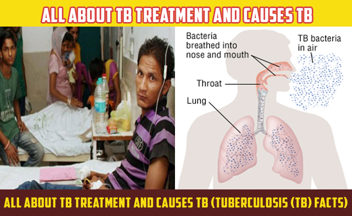 All about TB treatment & symptoms and causes TB (Tuberculosis (TB ...