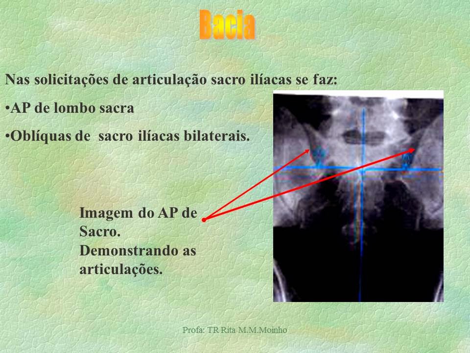 radiologia convencional : Raio-x de Bacia e articulações sacro ilíacas