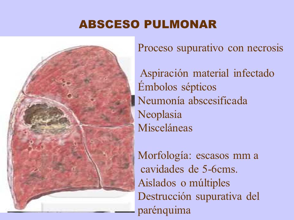 Semiología Quirúrgica