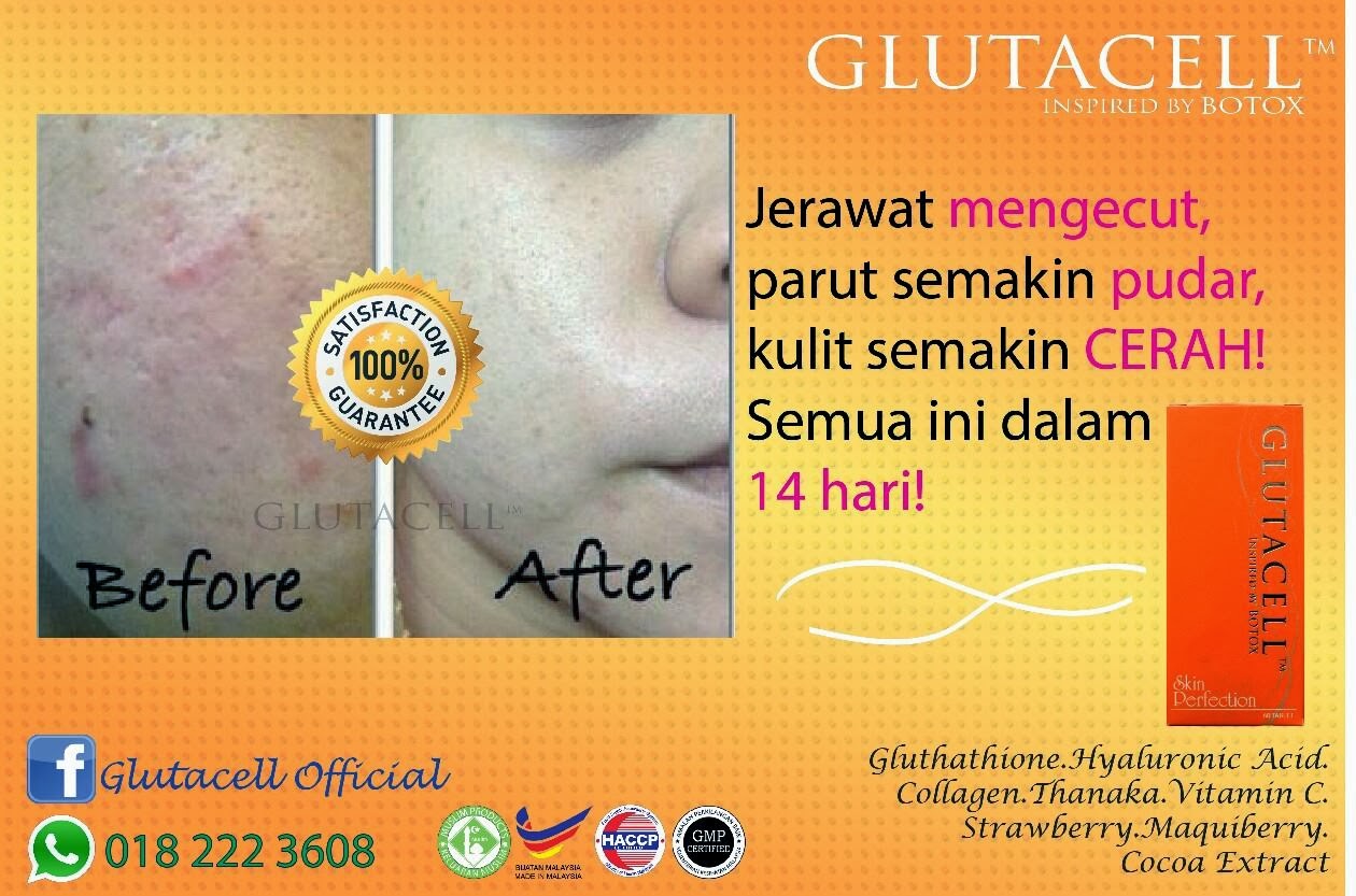 GlutaCell Inspired By Botox (RAHSIA KECANTIKAN DAN KESEMPURNAAN ANDA)