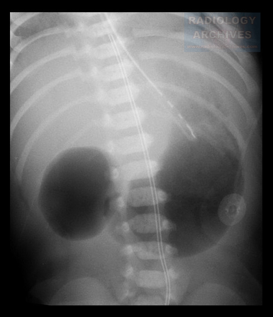 Radiology Archives: Μαΐου 2013