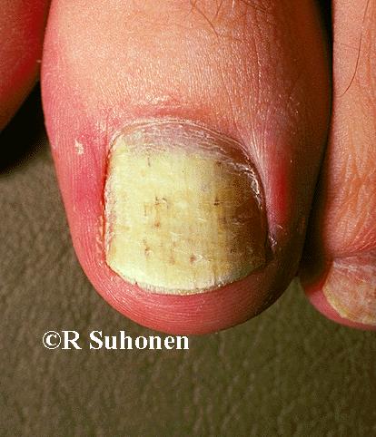 Life is too short to have boring hair: Ihosairaudet