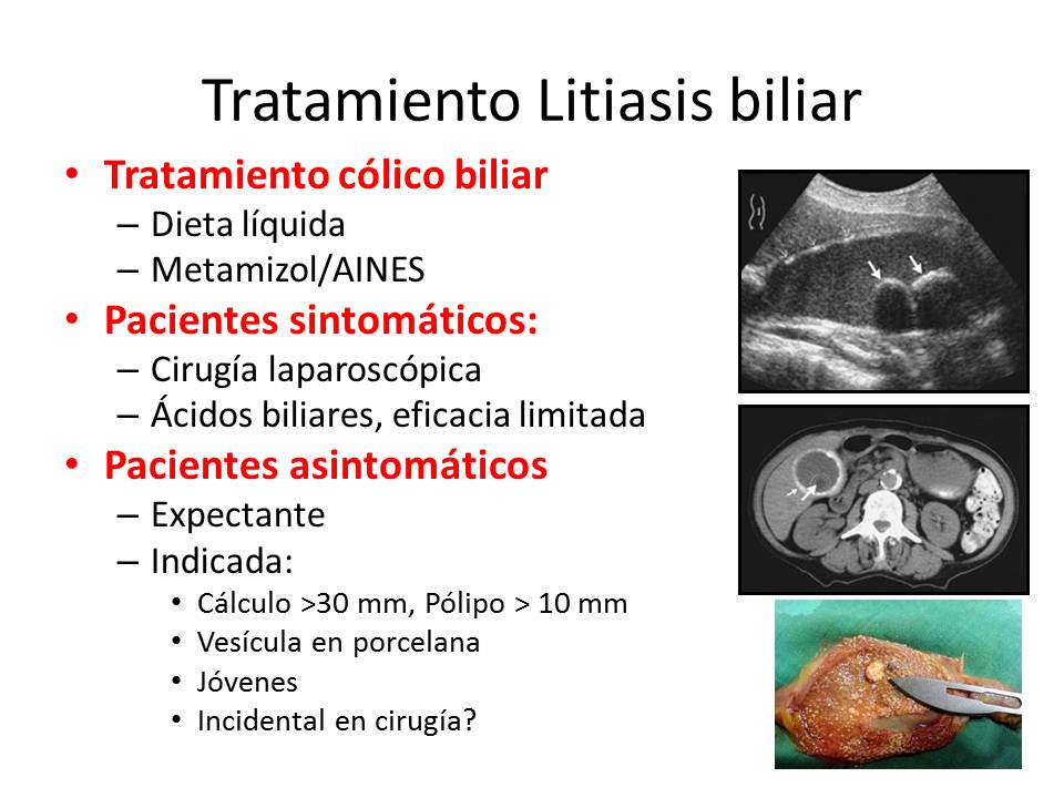 ALFREDO JIMÉNEZ BERNADÓ: SEMINARIO ENFERMEDADES DE LA VÍA BILIAR