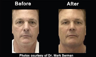 Jacksonville Plastic Surgery and Cosmetic Surgery | Breast Augmentation ...