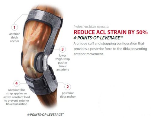 dr. sober-companion: open knee surgery for torn acl requires donjoy ...