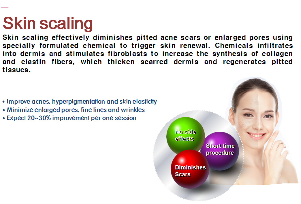 ID Hospital Korea: Best Acne Treatments in Korea