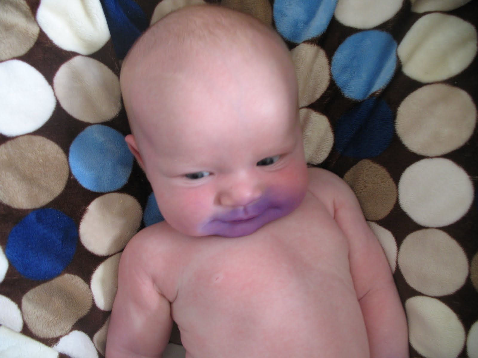 Guggins: Gentian Violet thrush treatment