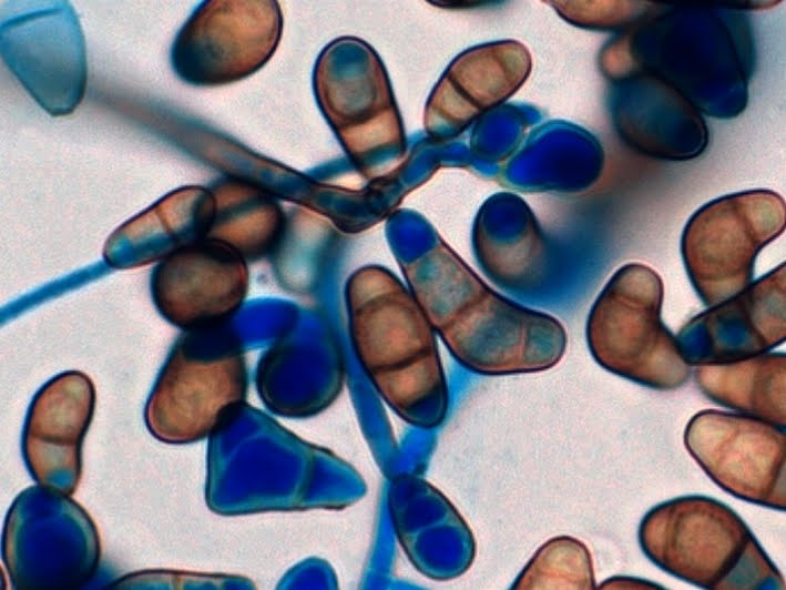 Fun With Microbiology (What's Buggin' You?): Curvularia sp.