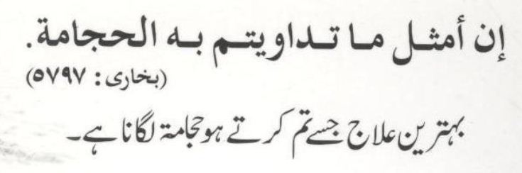 Al Hijama / The Cupping Therapy: Hadiths of Prophet Muhammad S.A.W.W on ...