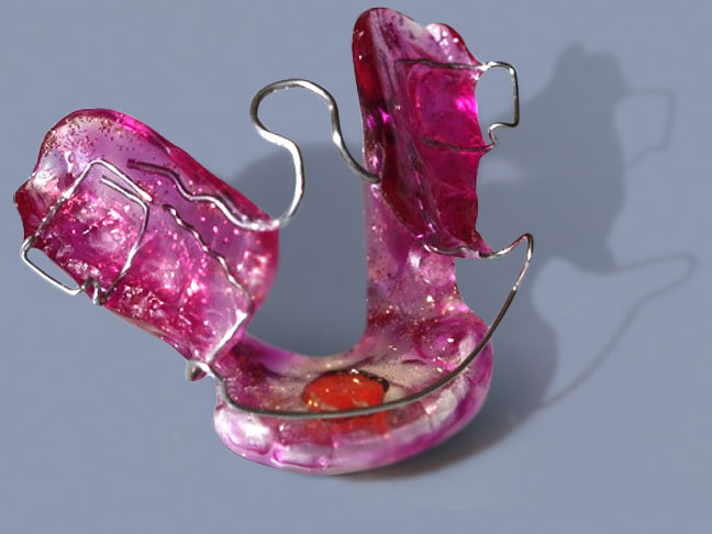 Dentistry and Medicine: Functional appliances-Orthodontic Lecture note